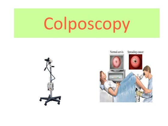 ASCCP Colpo Certification | PDF