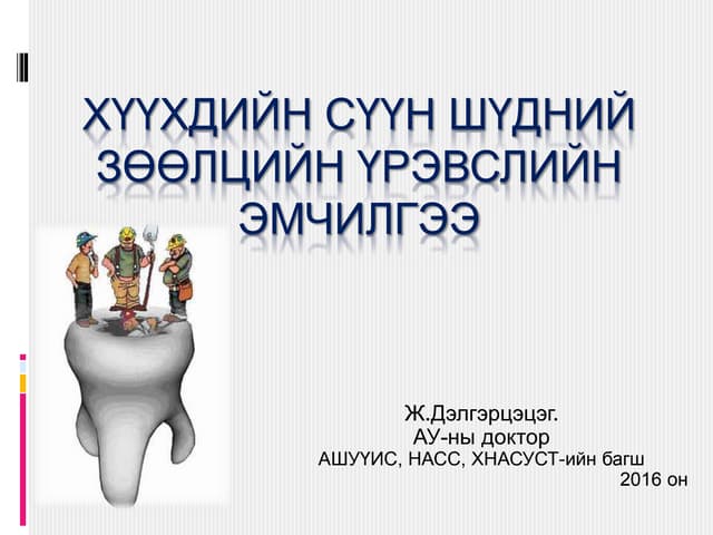 хүүхдийн сүүн шүдний зөөлцийн үрэвслийн эмчилгээ Pptx