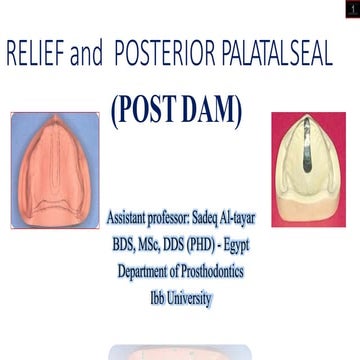 Post damming المحاضرة 8+9 | PPT