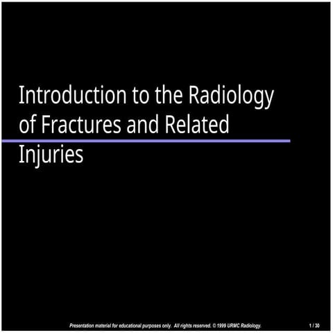 iodine insufficiency diseases.......pptx