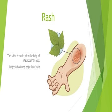 Rash | PPT