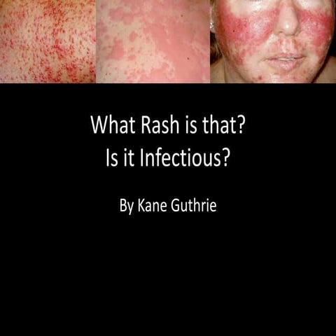 What's Rash is that! | PPT