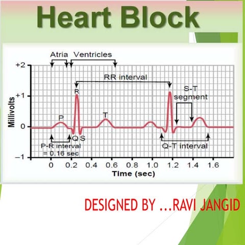 heart block presentation (1) | PPTX | Heart and Cardiovascular Diseases ...