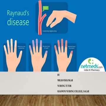 Raynaud's disease.pdf