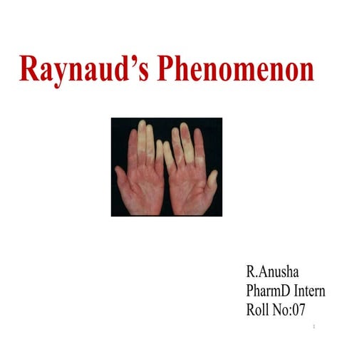 Nursing management Of patients with Raynaud's disease | PPTX