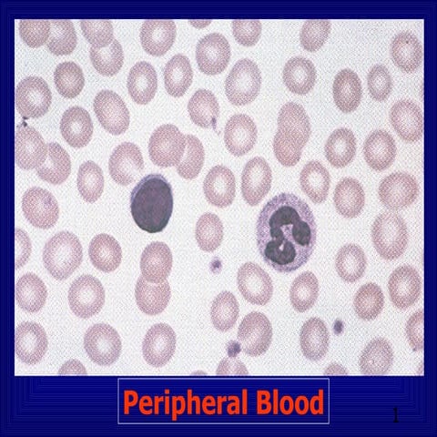 Rbc | PPT | Blood Disorders | Diseases and Conditions