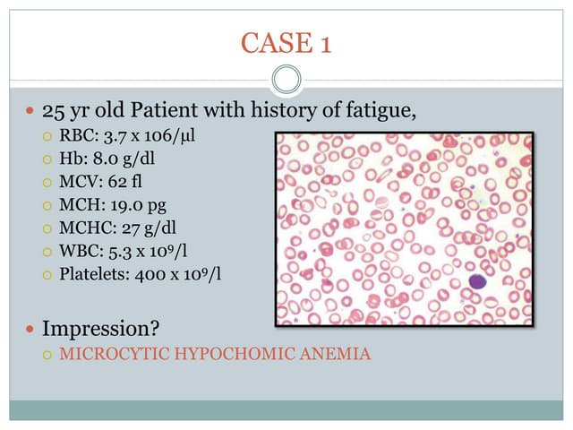 RBC Indices- MCV, MCH, MCHC II Blood Physiology | PDF
