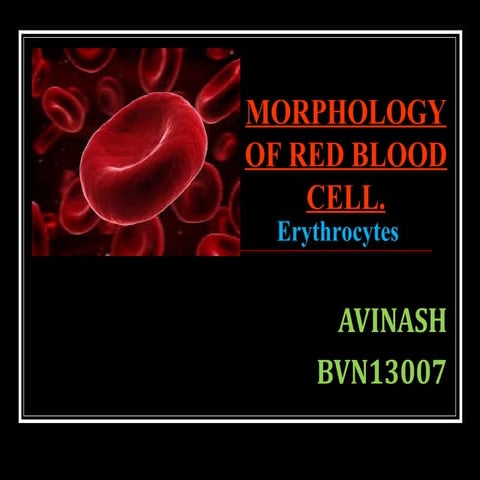 Rbc morphology | PPT