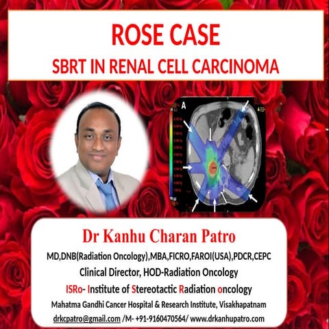 ROSE CASE RCC SBRT BY DR KANHU CHARAN PATRO | PPTX