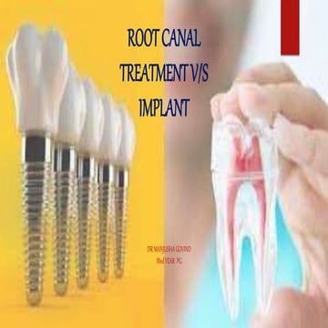 RCT VS IMPLANT.pptx