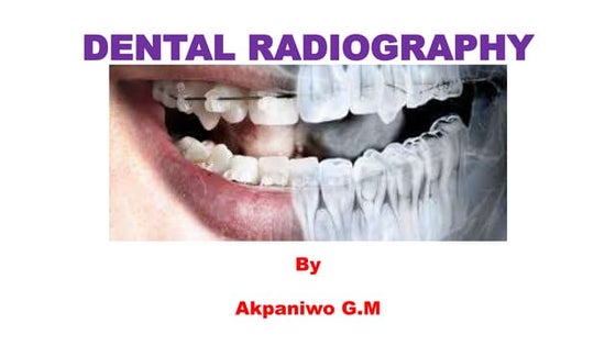 Bitewing radiographry | PPT
