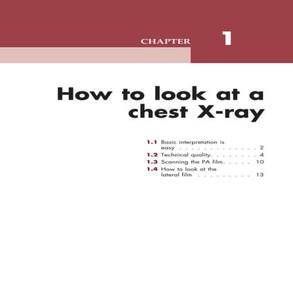 Reading chestxray | PDF