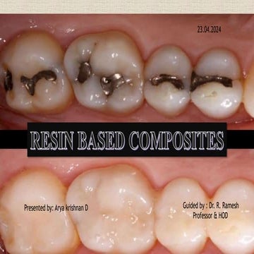 RECENT ADVANCES IN COMPOSITES (2).pptx