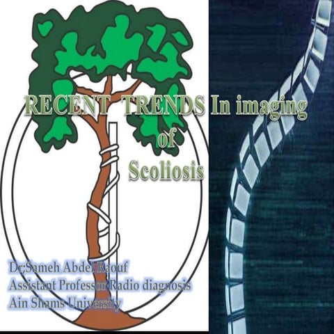 Lenke Classification for Adolescent Idiopathic Scoliosis (AIS) | PPTX