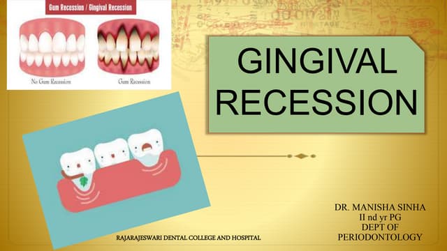 Free gingival graft | PPTX