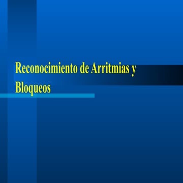Reconocimiento de Arritmias y Bloqueos ANTONELLA.pptx