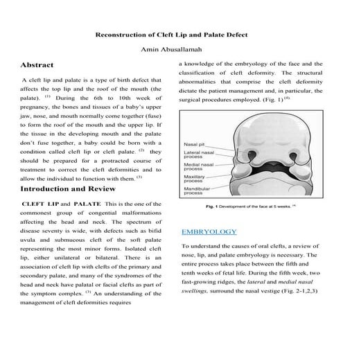 Article of Reconstruction of cleft lip and palate defect | PDF