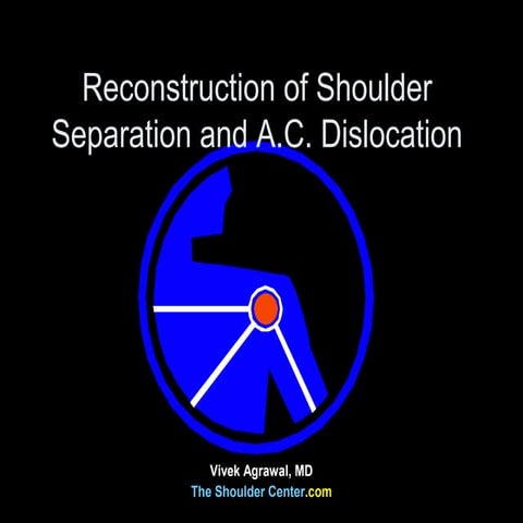 Reconstruction of Shoulder Separation and A.C. Dislocation | PPT