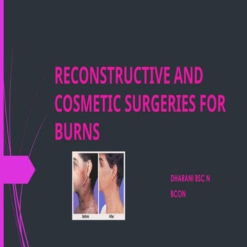 RECONSTRUCTIVE SURGERIES-1.pptx. bsc nursing | PPTX