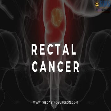 Rectal cancer | PDF