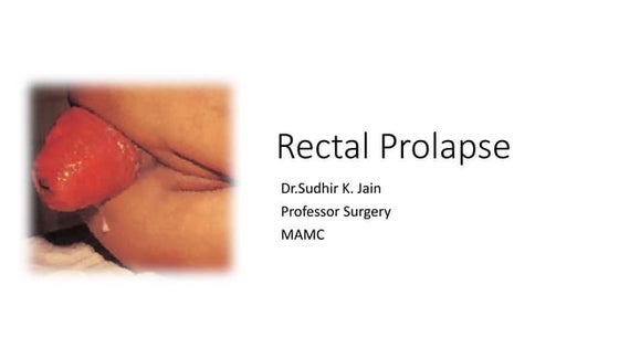 RECTAL PROLAPSE | PPT