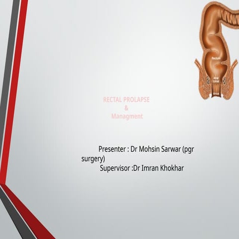 Causes, risk factors, management and complications associated with rectal prolapse | PPTX