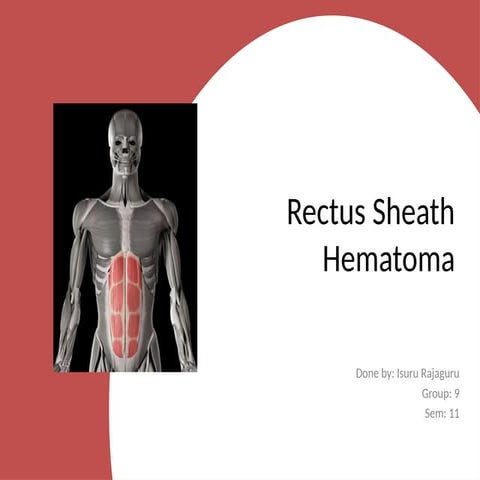 Rectus Sheath Hematoma - A surgical aspect | PPTX