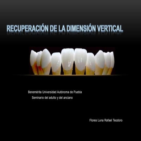Recuperación de la dimensión vertical | PPTX