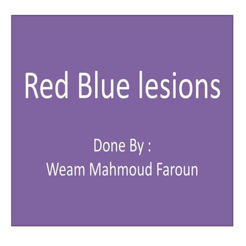 Red blue-lesin | PPTX