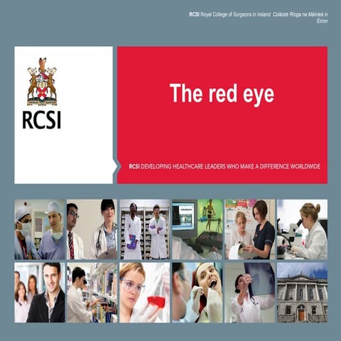 opthalmology Red Eye - medicine and healthcare | PPTX