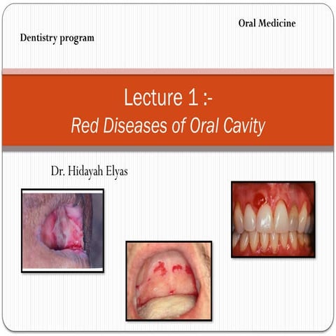 Red Lesions in oral cavity oral medicine | PPT