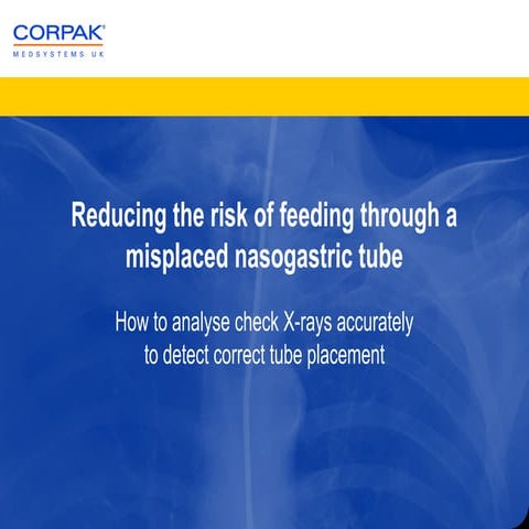 Prevention of aspiration 2 | PPTX