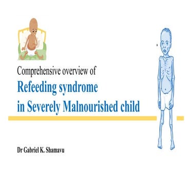 Pediatric Refeeding syndrome: comprehensive overview.pptx