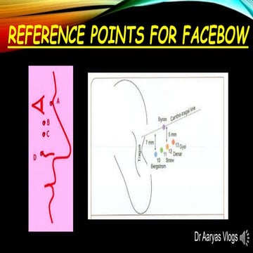 Reference points for facebow | PPTX