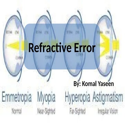 refractive error.pptx . . . . . . . . | PPT