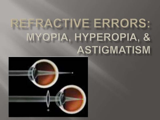 defects of eye class 10 phy | PPTX