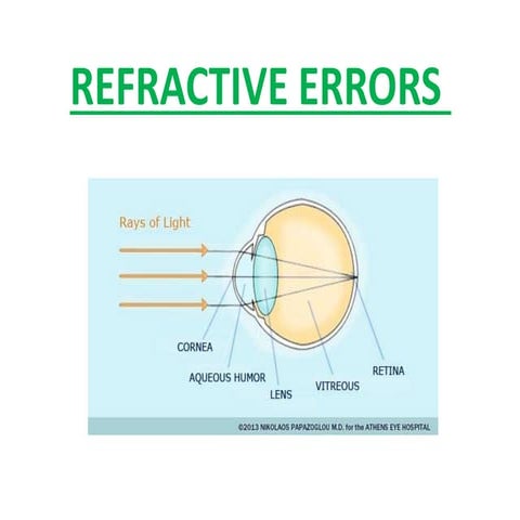 REFRECTIVE ERRORS.pptx refraction errors | PPT