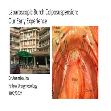 refreshed laparoscopic burch colposuspension.pptx