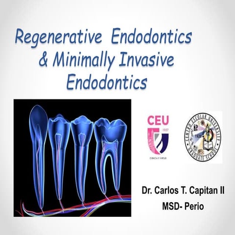 Regenerative Endodontics | PPTX