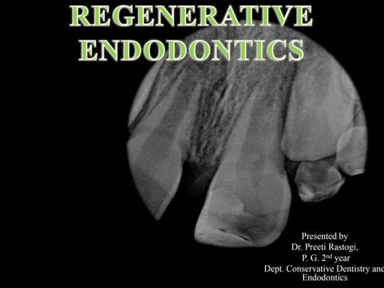 Apexogenesis & apexification | PPTX | Dental Health | Diseases and ...