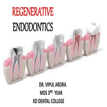 Regenerative endodontics | PPTX