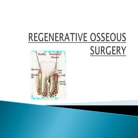 REGENERATIVE OSSEOUS SURGERY - NON BONE GRAFT | PPTX