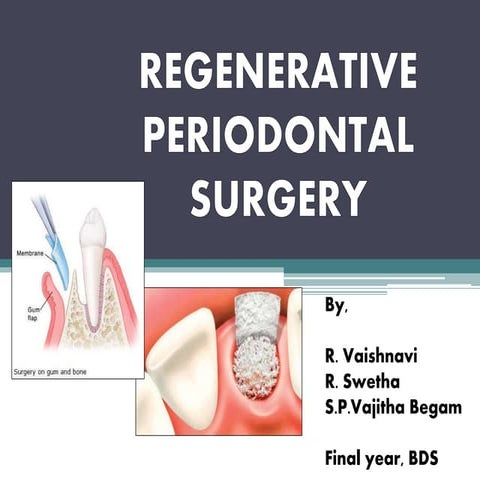 Ridge Augmentation Procedures | PPTX