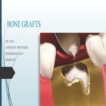 Comprehensive Overview of Bone Grafts in Regenerative Osseous Surgery ...