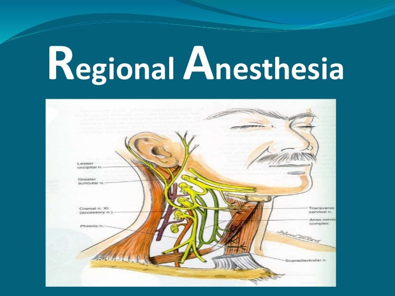 Regional Anesthesia Other Term at Jenny Abate blog