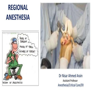 #Regional anesthesia | PPTX