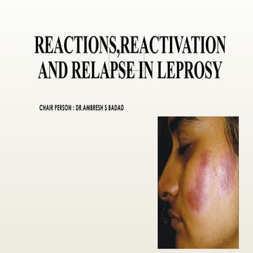 Relapse,reactivation,reactionsof leprosy.pptx