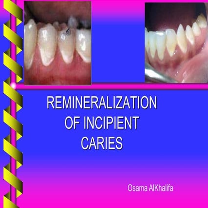 Remineralization 1 | PPT