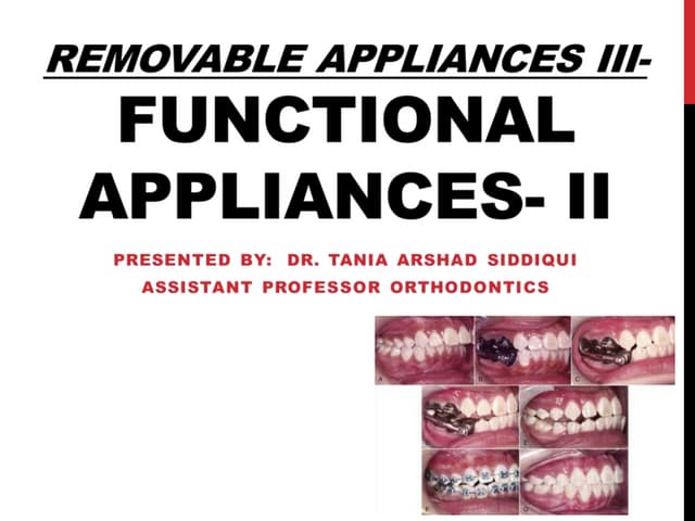 7. removable appliances | PPTX