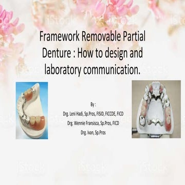 Removable Parial Denture.pptx